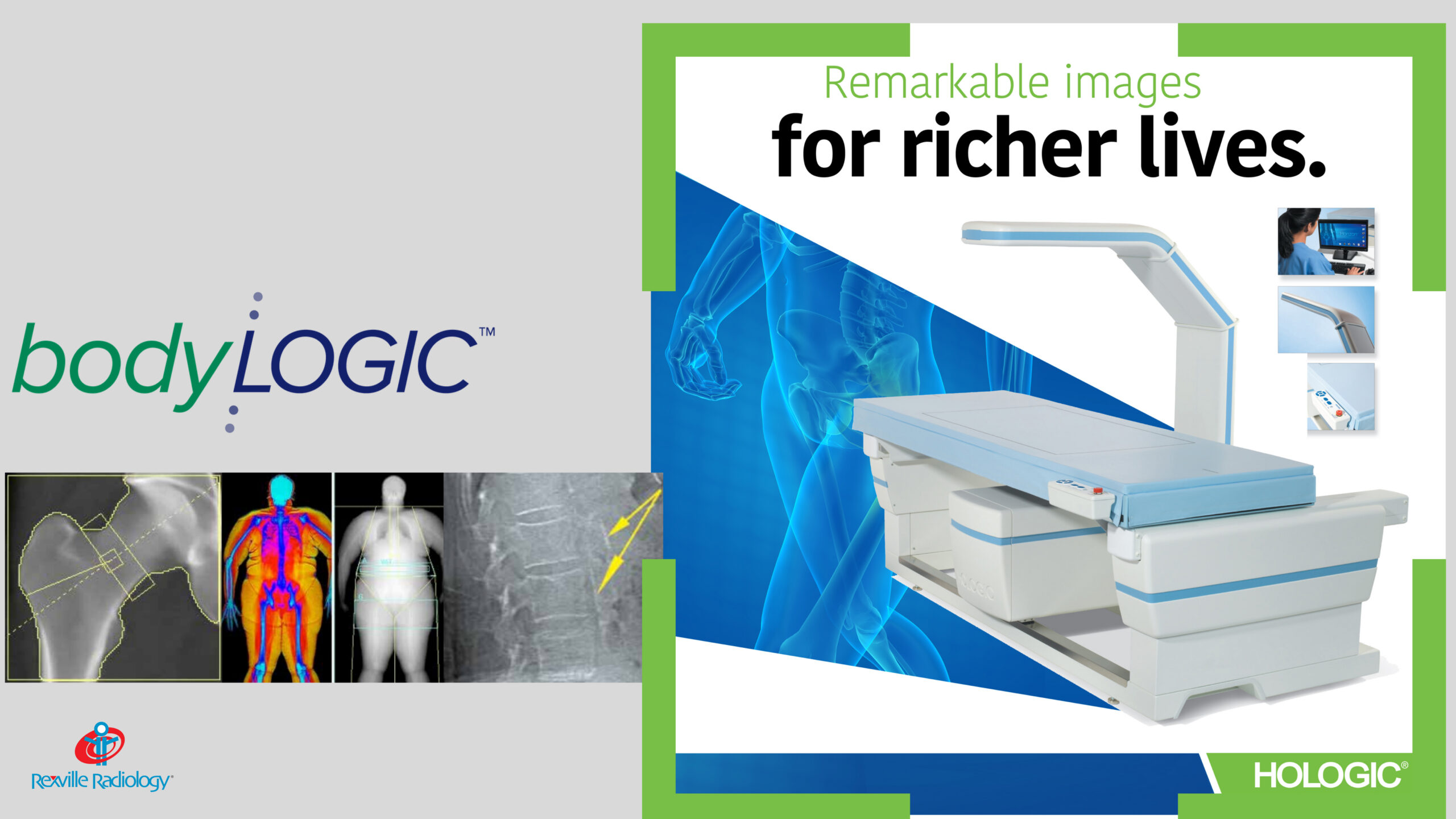 Rexville Radiology BODY LOGIC-5